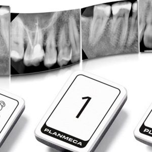 Planmeca ProSensor HD - La mejor Tecnología Dental | PLA