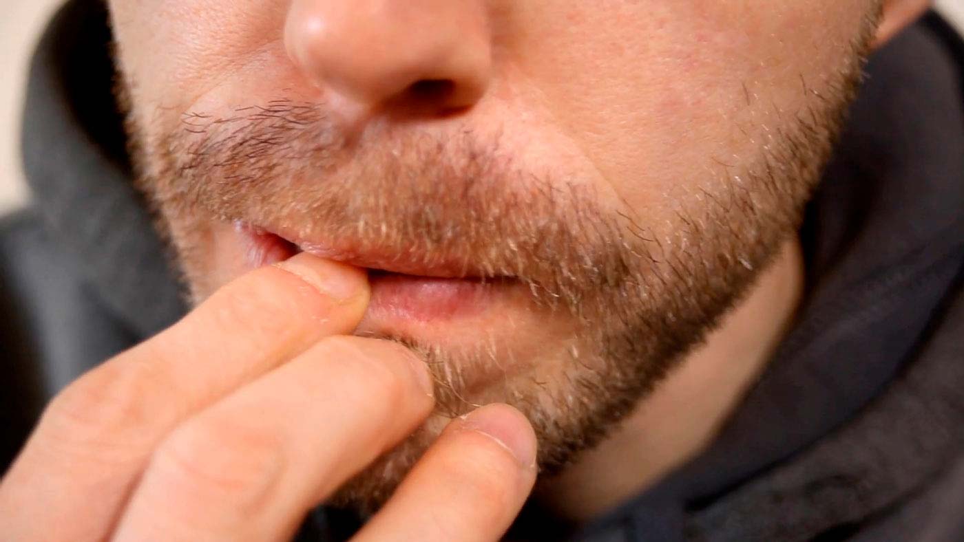 Morder las uñas, un hábito que puede dañar nuestros dientes | PLAdental